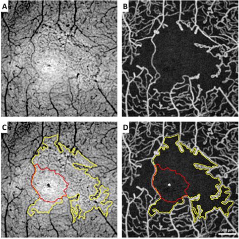 Comparison Of A Contrast Inverted En Face Oct Reflectance And B Download Scientific Diagram