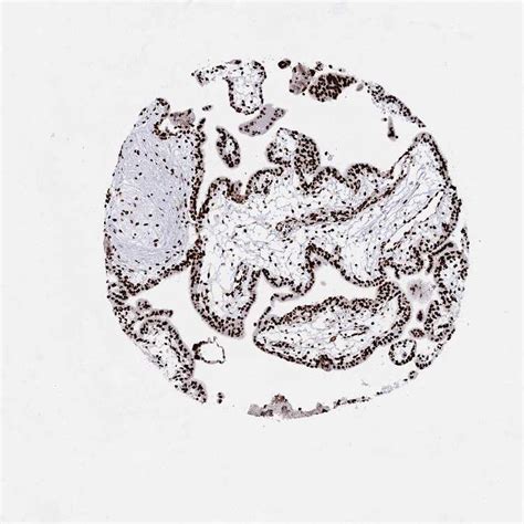 Tissue Expression Of Hmgb2 Staining In Placenta The Human Protein Atlas
