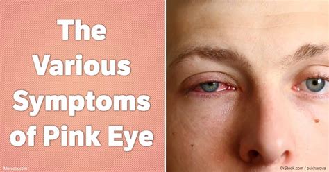 Pink Eye Symptoms Runny Nose At Evelyn Mcelroy Blog