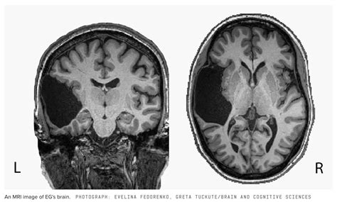 The Cerebellum Beyond Motor Control Trenton Bricken Interested In Machine Learning