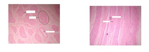 Nerve Cross Section And Longitudinal Section Diagram Quizlet