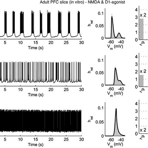 Nmda Induced Spiking Patterns In An Adult Rat Prefrontal Cortex Slice