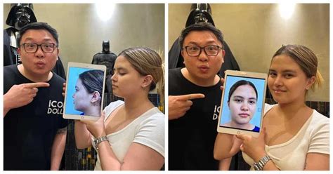Antonette Gail Shows Epic Improvement Of Her Nose After Surgery Kami