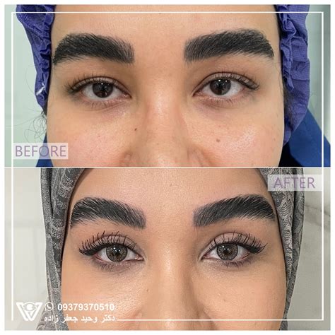 ‎دکتر وحید جعفرزاده‎ Drvahidjafarzadeh • Instagram Photos And Videos