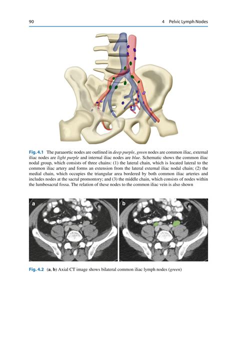 Solution Pelvic Lymph Nodes Studypool