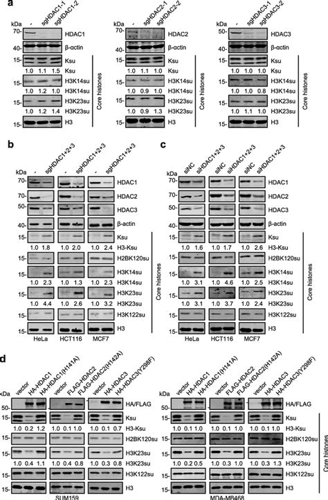 Class I Hdac 123 Are The Major Histone Desuccinylases In Mammalian