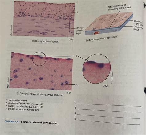 [solved] Sectional View Of Simple Squamous Cell Basement Membrane