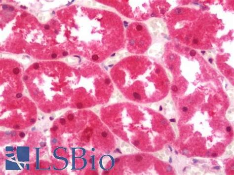 Ihc Plus™ P2rx7 P2x7 Polyclonal Antibody Rabbit Anti Human Lsbio