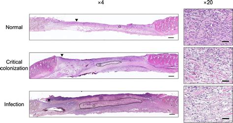 Histology Of Granulation Tissue N Normal Group Cc Critical