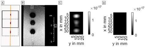 Overview Of The Marked Guidewire A And The Image Results In Mri B