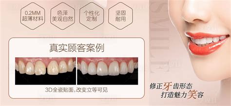 阳谷张顺口腔诊所