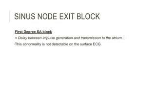 Sinus Node Dysfunction PPT