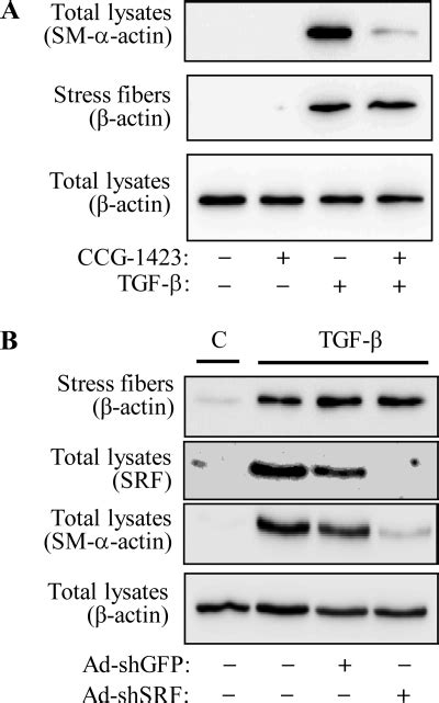 Delayed Stress Fiber Formation Mediates Pulmonary Myofibroblast