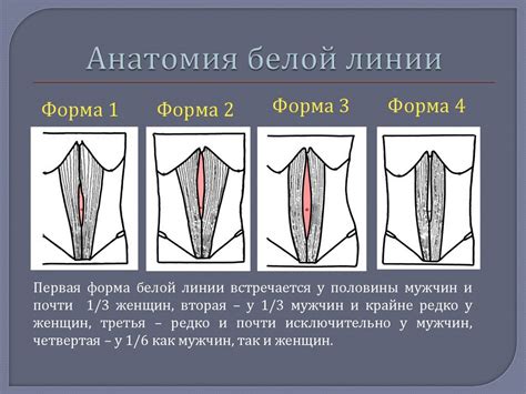 Грыжи белой линии живота online presentation