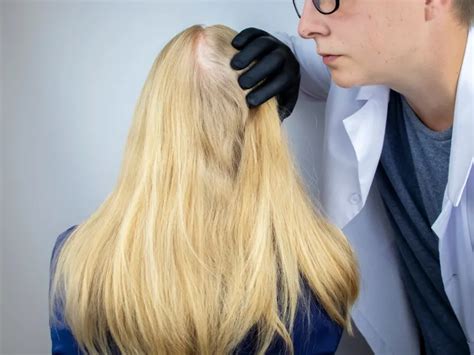 Top 103 Scalp Burning While Dying Hair Polarrunningexpeditions