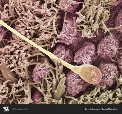 The Fate Of Sperm Centrioles • Chord