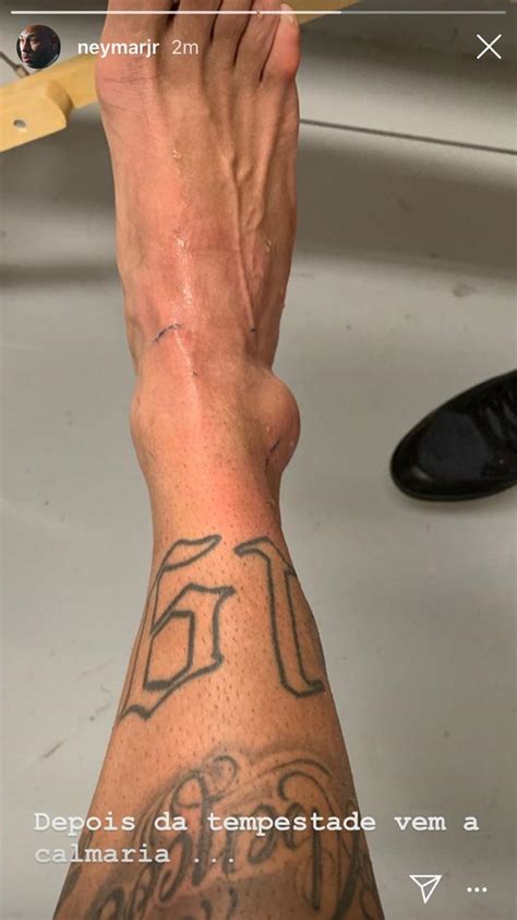 Neymar Posta Foto Do Tornozelo Inchado No Instagram Calmaria ESPN