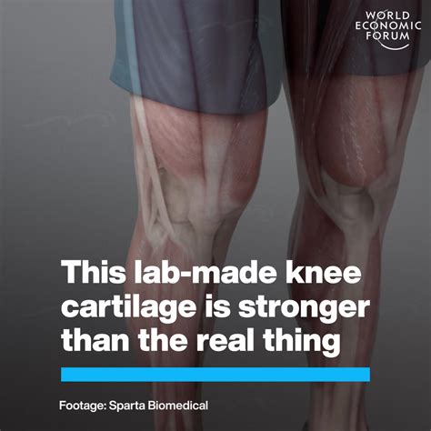 Lab Made Cartilage Gel Outperforms The Real Thing World Economic Forum