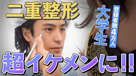 【メンズ二重整形】大学生が二重整形したら人生が変わったみたいです Youtube