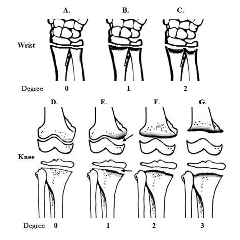 Reference Ranges Of Tmp Gfr According To Age And Sex Download