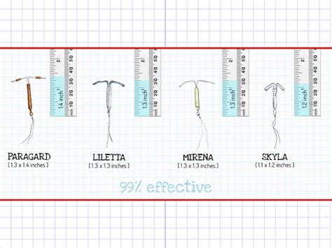 Copper Iud And Mirena Difference At Lynda Jones Blog