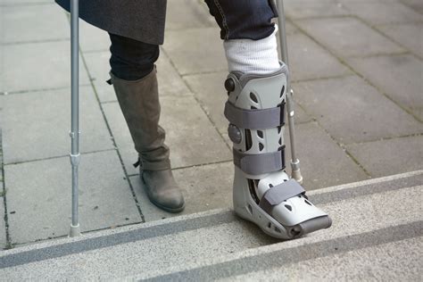 What Ankle Fracture Treatment Is Right For You Town Center Orthopaedics