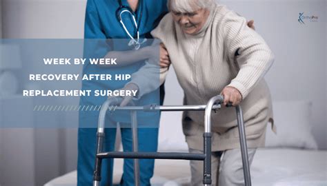 Tibia Fracture Recovery Timeline Treatment And Exercises