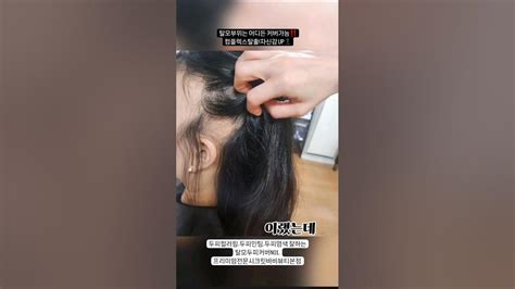 휑한 탈모부위는 어디든 오케바리👌~이제 걱정하지마세요🖤탈모두피커버전문no1프리미엄전문샵and아카데미두피페인팅두피컬러링두피염색 수강교육시술예약중시크릿바비뷰티본점