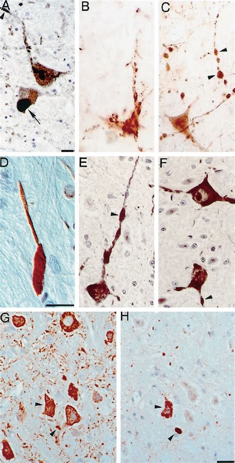 Figure 7 From Neuropathology In Mice Expressing Human α Synuclein Semantic Scholar