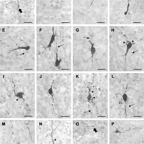 Stages Of Cellular Maturation And Degeneration A Migrating Neuron In
