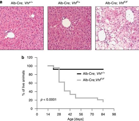 Albumin Cre Vhlff Mice Develop Liver Steatosis And Exhibit A