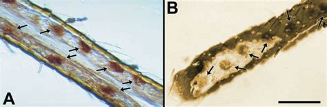 Immunocytochemical Localization Of Lap In Lygus Lineolaris Antennae
