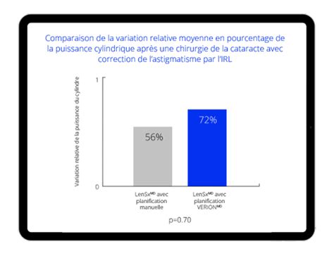 Le Biomètre Argos Alcon Canada