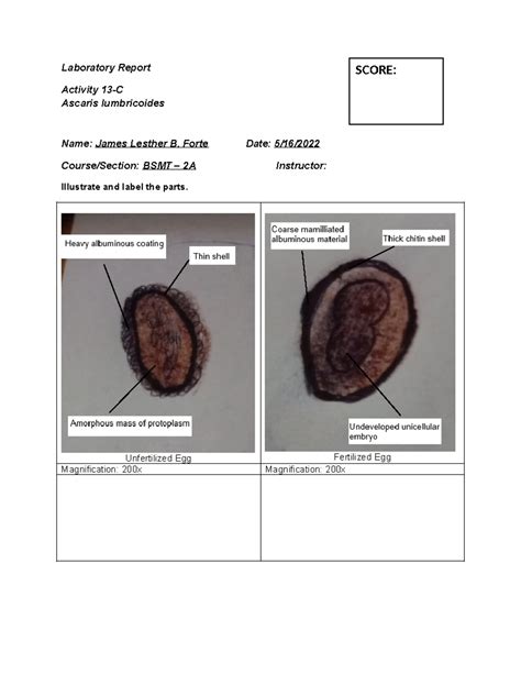 Activity 10 A Lumbricoides Laboratory Report Activity 13 C Ascaris