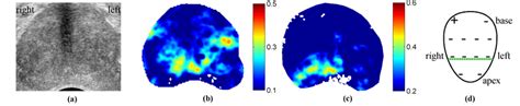 A B Mode B 2d And C 3d Correlation R And D Results From A