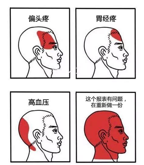 常见头疼分类和位置图 头疼分布图 头痛位置分布图 大山谷图库