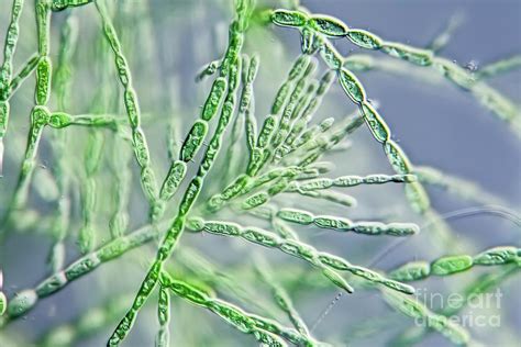 Batrachospermum Sp Photograph By Gerd Guenther Science Photo Library