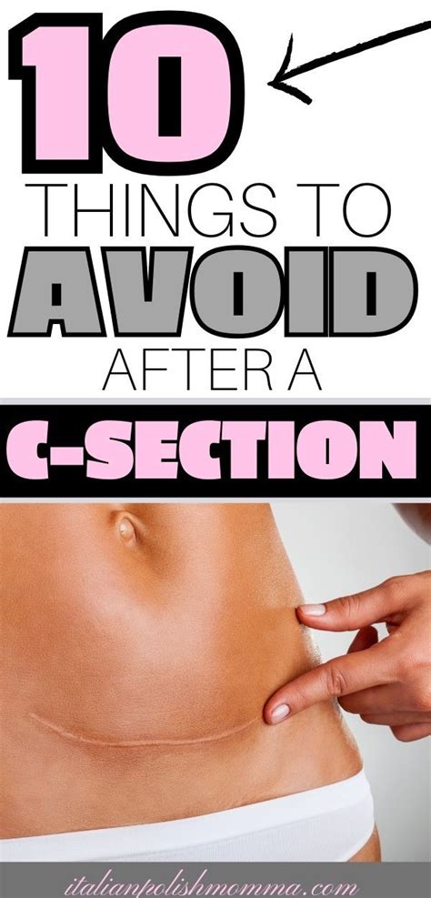 Exercise After C Section Artofit