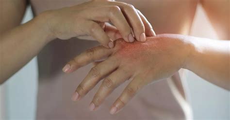 Non Hodgkin Lymphoma Symptoms Including Itching Night Sweats And Tiredness The Mirror