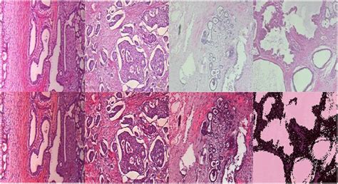 Examples Of Stain Normalization Process Using Non‐linear Mapping Stain Download Scientific