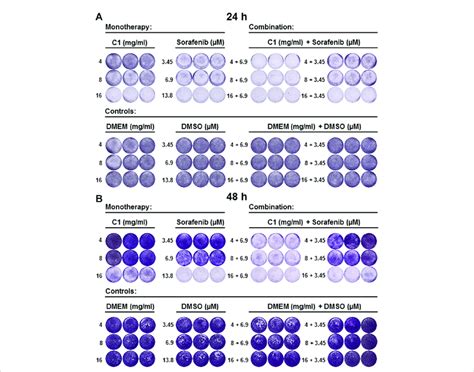 C1 And Its Combination With Sorafenib Inhibited The Growth Of Hcc In A
