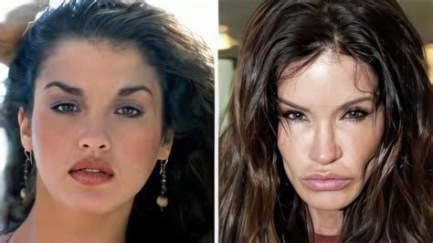 Worst Plastic Surgery Before And After