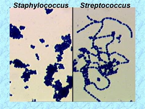 Streptococci Part 1 Dr Salma Morphology And Identification