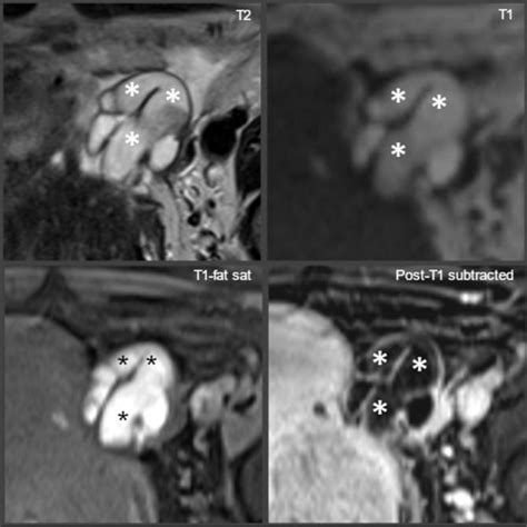 Orads Calculator And Report Generator Us And Mri
