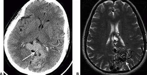 Vascular Abnormalities Radiology Key