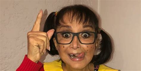 Revelan El Nuevo Rostro De La Chilindrina Tras Hacerse Un Retoque