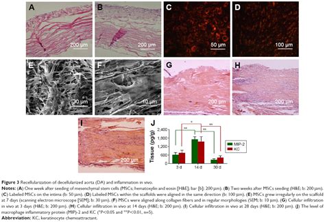 Preparation Of A Nano And Micro Fibrous Decellularized Scaffold Seede