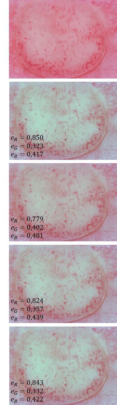 Color Constancy Examples Benign From Top To Bottom Original Image Download Scientific