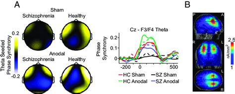 Interregional Phase Synchrony A Topographical Maps Of Cz Seeded Download Scientific Diagram