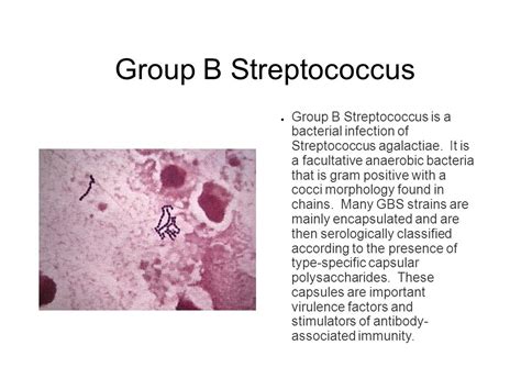 Streptococcus Agalactiae Gram Stain
